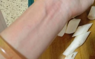 山药痒手怎么办_最有效方法