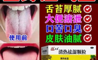 祛湿颗粒的功效与作用_祛湿颗粒适合什么人吃