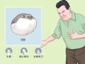 河豚毒素中毒症状_河豚毒素解毒方法