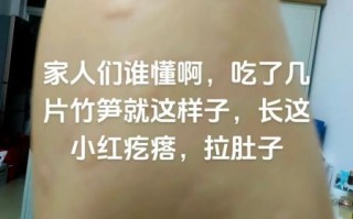 竹笋中毒的症状_怎么处理