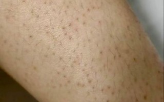 鸡皮肤是什么样子_鸡皮肤图片特征解析