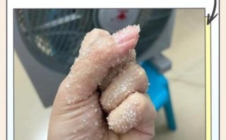 辣椒辣手怎么办_辣椒辣手最严重后果