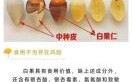 银杏果的功效与作用_银杏果的正确吃法