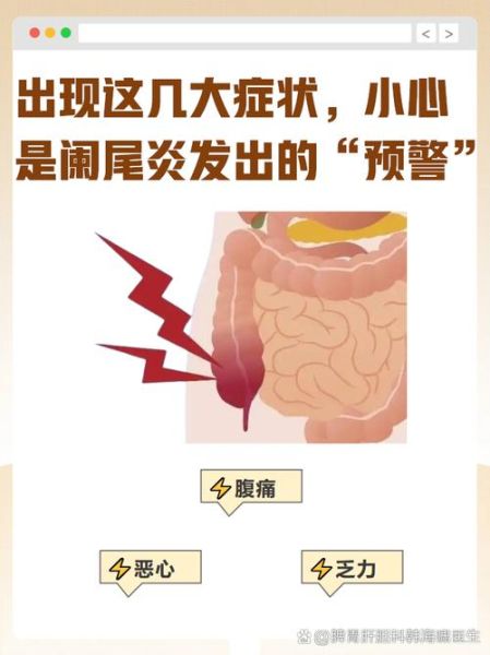 女性阑尾炎早期症状有哪些_女性阑尾炎和月经痛区别-第3张图片-山城妙识 女性阑尾炎早期症状有哪些_女性阑尾炎和月经痛区别-第3张图片-山城妙识