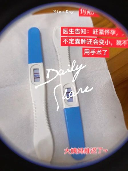 巧克力囊肿手术后能怀孕吗_术后多久可以备孕-第2张图片-山城妙识