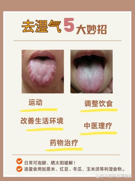 男人湿毒太重十大表现_如何快速祛湿-第3张图片-山城妙识