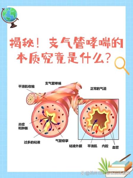 过敏性支气管哮喘的最佳治疗方法_如何根治不复发-第3张图片-山城妙识 过敏性支气管哮喘的最佳治疗方法_如何根治不复发-第3张图片-山城妙识