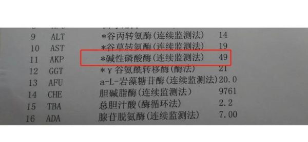 碱性磷酸酶偏高怎么办_碱性磷酸酶偏高吃什么-第1张图片-山城妙识 碱性磷酸酶偏高怎么办_碱性磷酸酶偏高吃什么-第1张图片-山城妙识