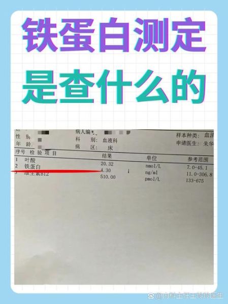 铁蛋白正常值范围_铁蛋白偏高偏低怎么办-第1张图片-山城妙识 铁蛋白正常值范围_铁蛋白偏高偏低怎么办-第1张图片-山城妙识