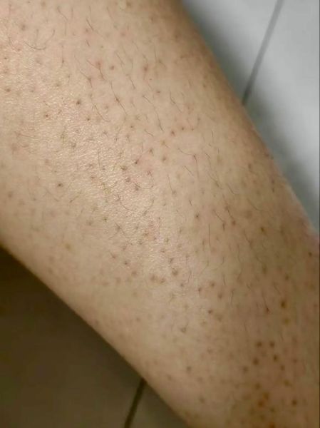 鸡皮肤是什么样子_鸡皮肤图片特征解析-第1张图片-山城妙识 鸡皮肤是什么样子_鸡皮肤图片特征解析-第1张图片-山城妙识