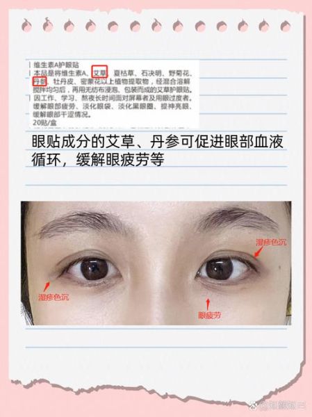 黑眼圈怎么消除_去黑眼圈最有效的方法-第2张图片-山城妙识