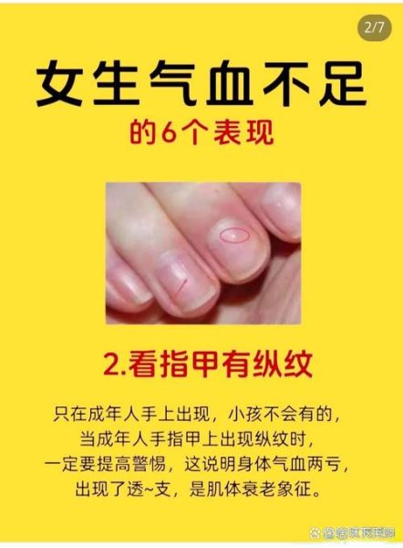 饮食养生大全_吃什么最补气血-第3张图片-山城妙识 饮食养生大全_吃什么最补气血-第3张图片-山城妙识