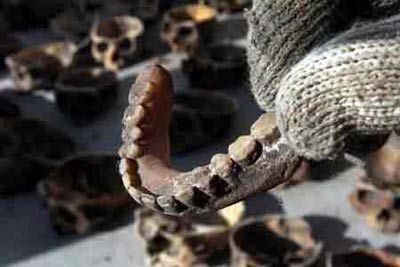 莲蓬乳图片空手指_是什么心理现象-第2张图片-山城妙识 莲蓬乳图片空手指_是什么心理现象-第2张图片-山城妙识