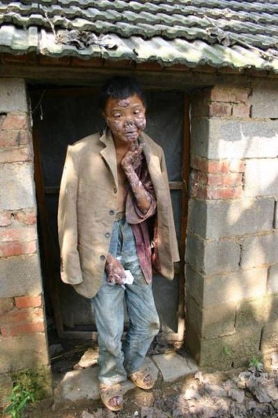 莲蓬乳图片空手指_是什么心理现象-第1张图片-山城妙识 莲蓬乳图片空手指_是什么心理现象-第1张图片-山城妙识