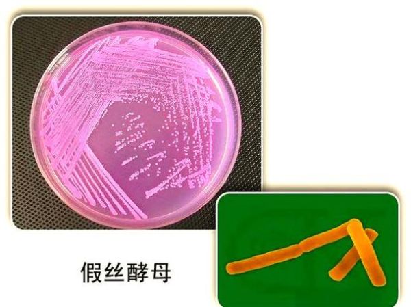 酵母菌如何繁殖_酵母菌繁殖方式有哪些-第3张图片-山城妙识