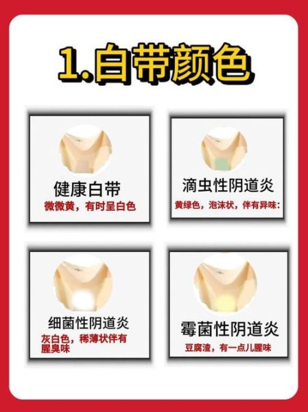 豆腐渣分泌物图片_豆腐渣样白带怎么回事-第2张图片-山城妙识 豆腐渣分泌物图片_豆腐渣样白带怎么回事-第2张图片-山城妙识