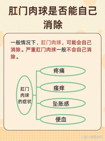 肛门肉球能自己消除吗_肛门肉球多久会好-第3张图片-山城妙识 肛门肉球能自己消除吗_肛门肉球多久会好-第3张图片-山城妙识