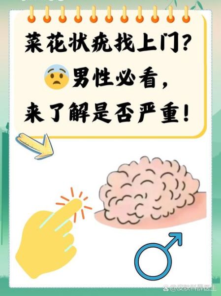 菜花疣是什么原因造成的_菜花疣是怎么引起的-第2张图片-山城妙识 菜花疣是什么原因造成的_菜花疣是怎么引起的-第2张图片-山城妙识