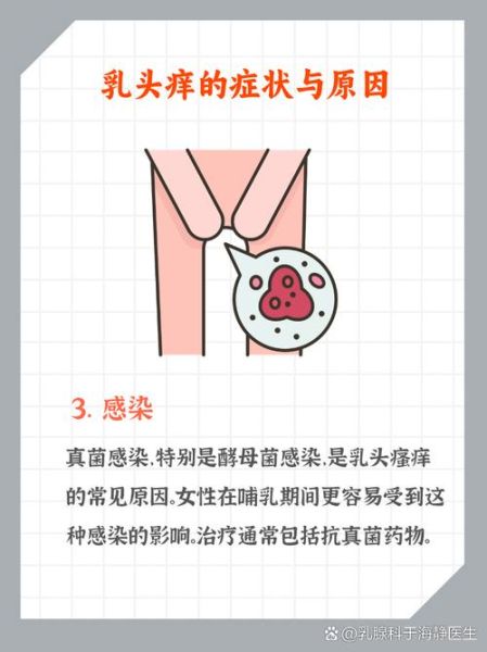 乳头痒是怎么回事_乳头疼痛怎么办-第1张图片-山城妙识 乳头痒是怎么回事_乳头疼痛怎么办-第1张图片-山城妙识
