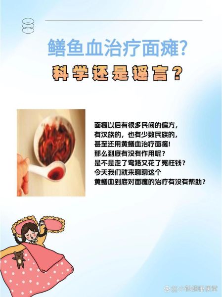 面瘫涂鳝鱼血最正确的方法_鳝鱼血治面瘫多久见效-第2张图片-山城妙识